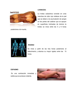 tanatologia, medicina legal | DOCX