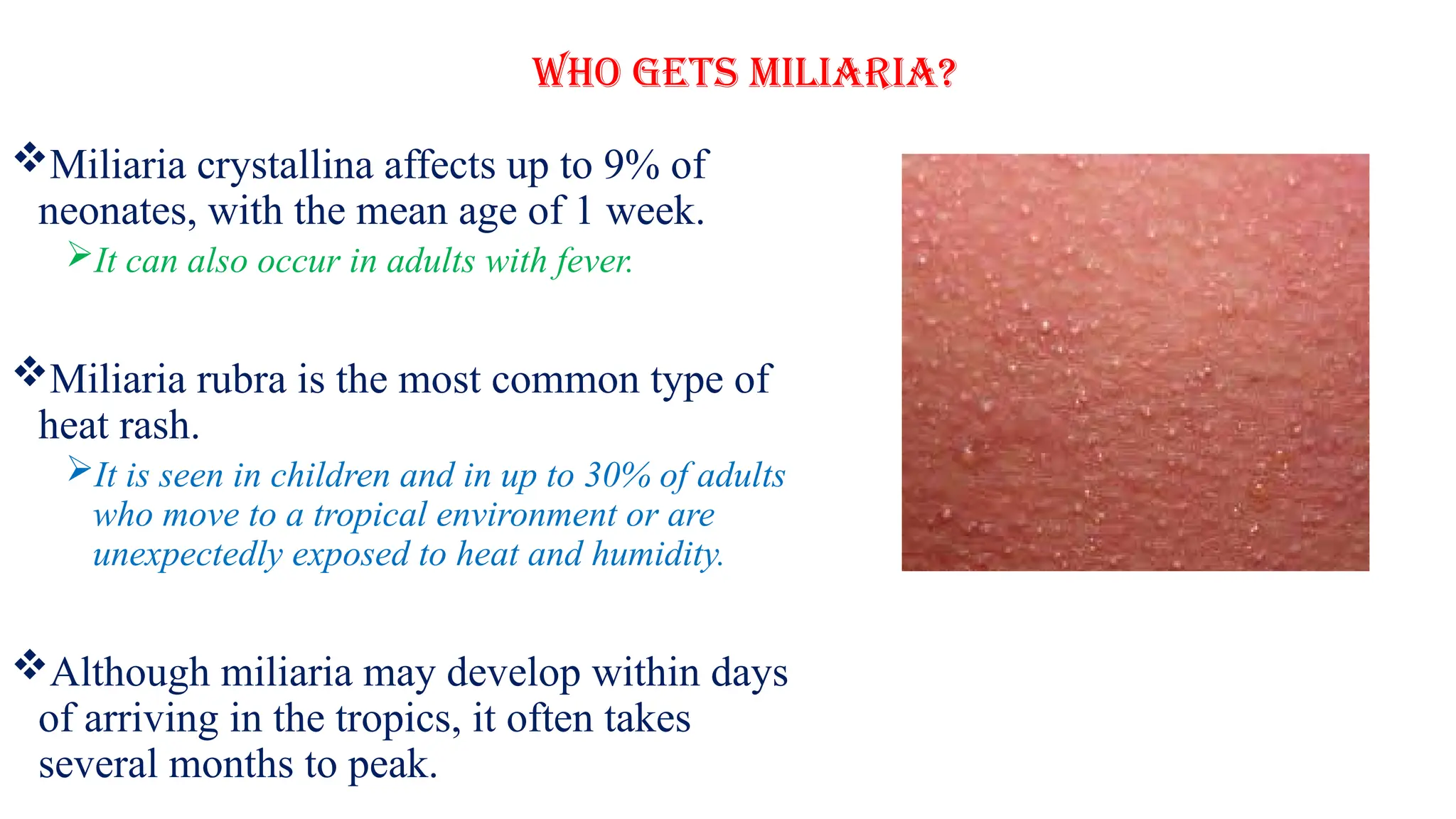 Miliaria(heat rash) - obstruction of sweat glands pptx | PPTX