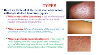 Miliaria(heat rash) - obstruction of sweat glands pptx | PPTX