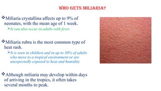 Miliaria(heat rash) - obstruction of sweat glands pptx | PPTX
