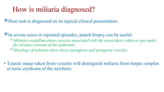 Miliaria(heat rash) - obstruction of sweat glands pptx | PPTX