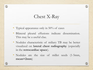 Miliary Tuberculosis (dr. mahesh) | PPT