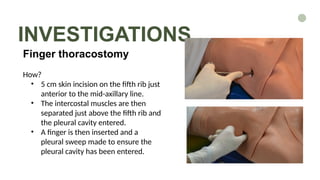 The presentation on the topic Chest Injury | PPTX