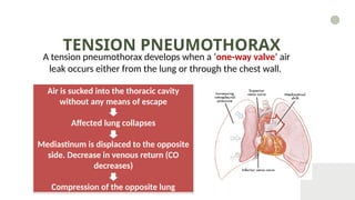 The presentation on the topic Chest Injury | PPTX