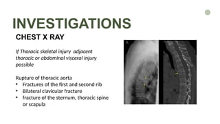 The presentation on the topic Chest Injury | PPTX