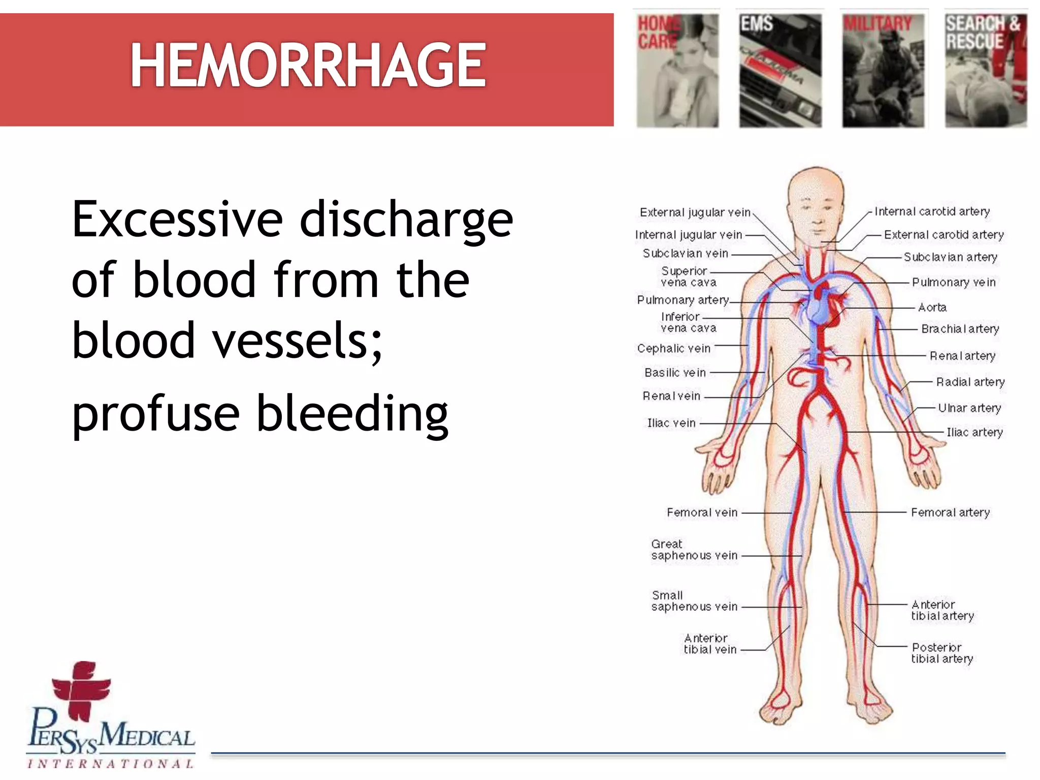 Military hemorrhage control presentation | PPTX