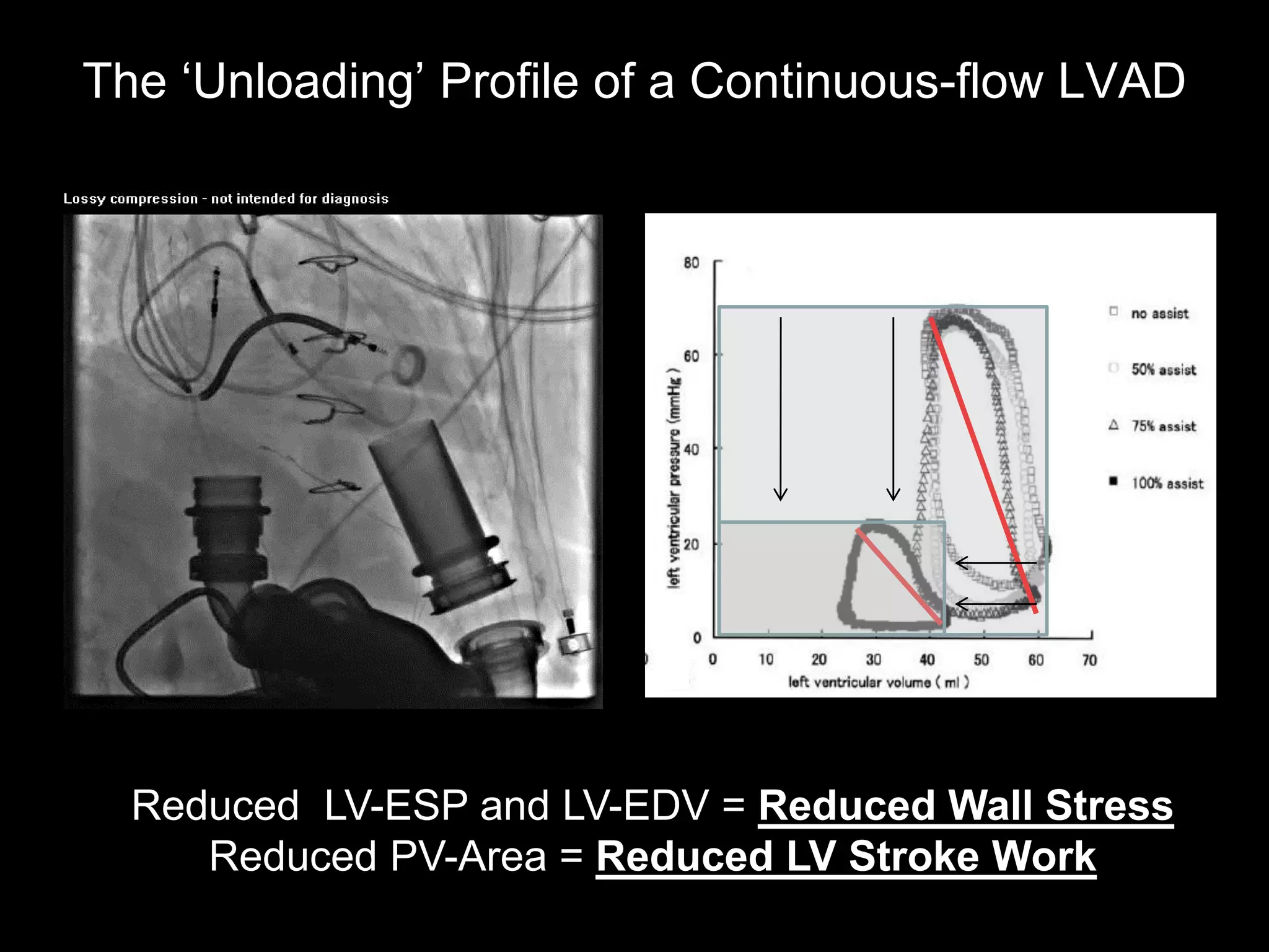 Understanding the Translational Value of PV Loops from Mouse to Man ...