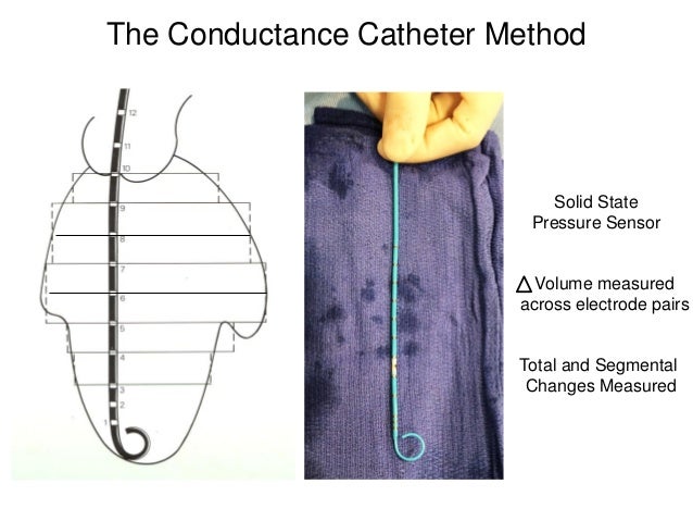 Understanding the Translational Value of PV Loops from Mouse to Man