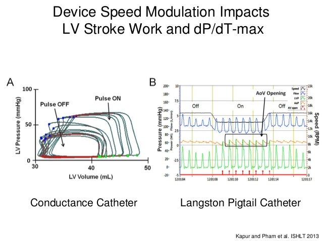 Understanding the Translational Value of PV Loops from Mouse to Man