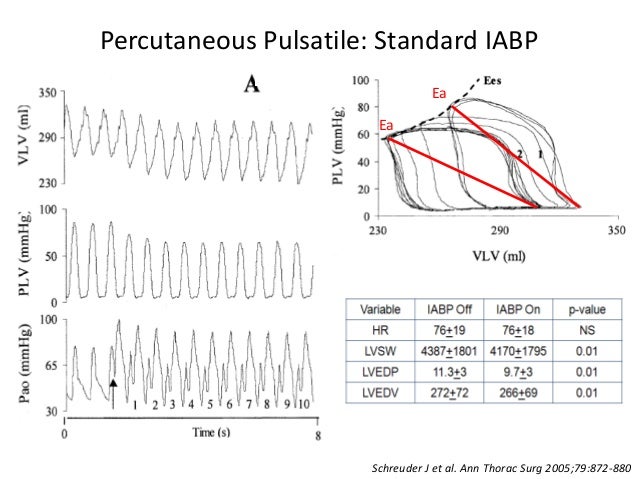 Lv Waveform Impella | Paul Smith