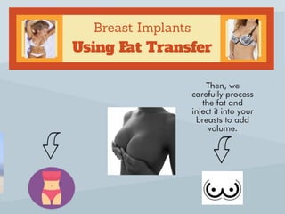 Breast Augmentation Options | PPT