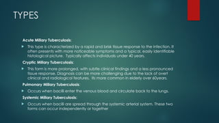 MILLIARY TUBERCULOSIS-1.pptx presented by LMMU | PPTX
