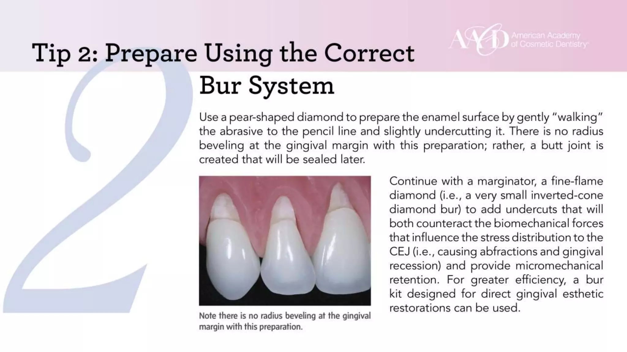 AACD Clinical Tips for Placing Direct Pink Prosthetics Using Gingiva ...