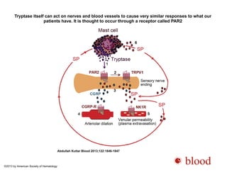 Milner Tryptase Research Update Slides | PPT