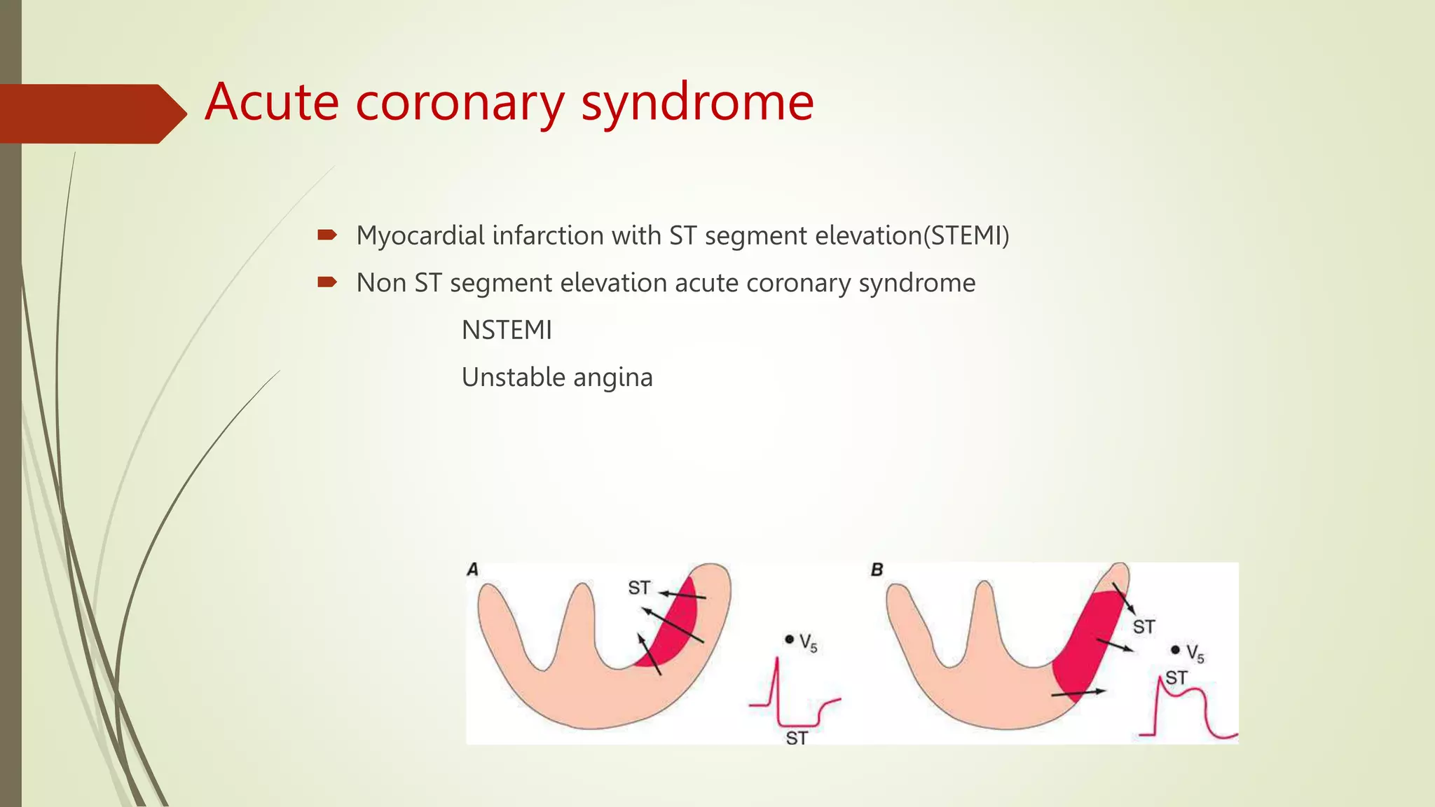 MI LOCALISATION.pptx