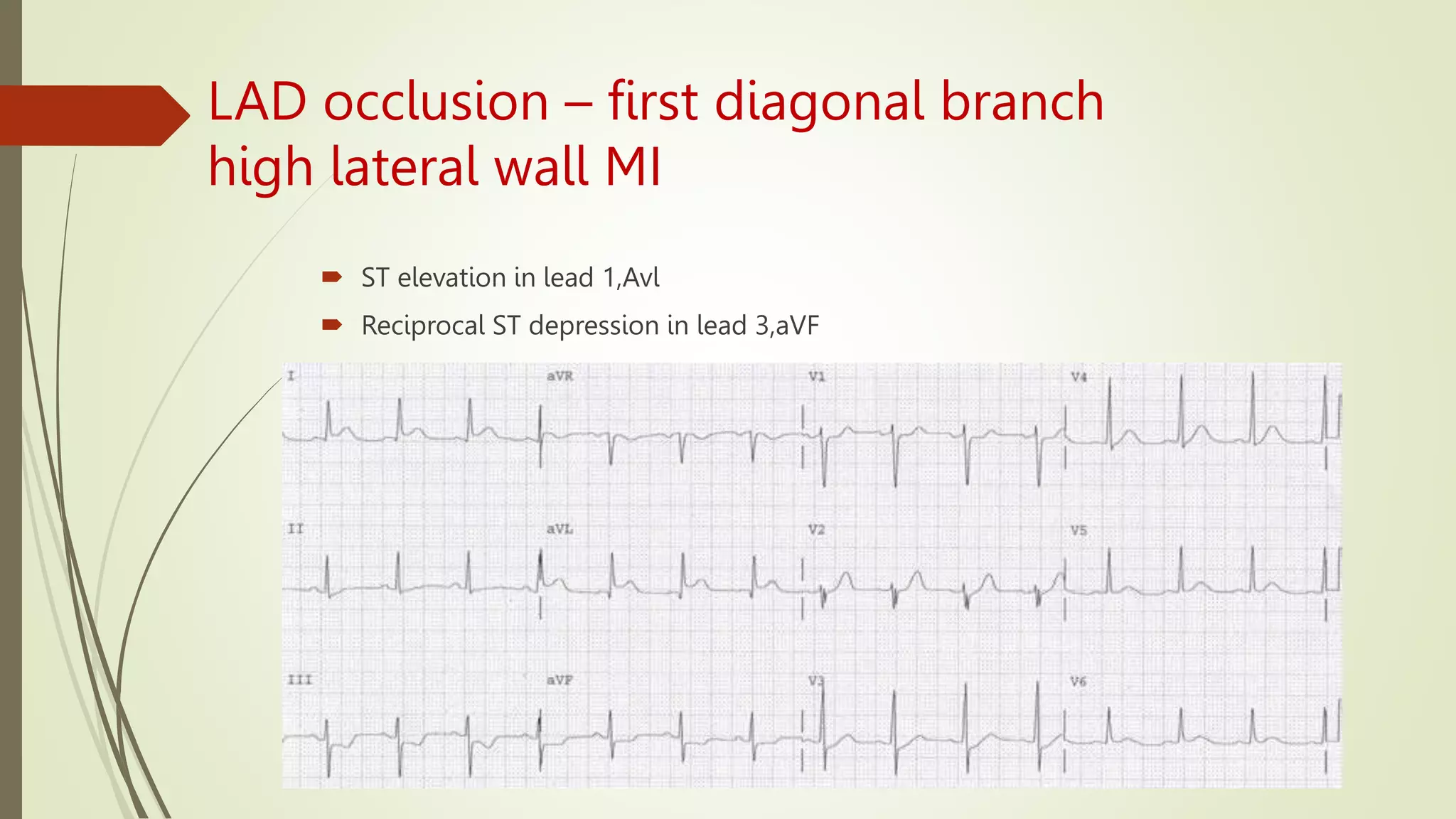 MI LOCALISATION.pptx