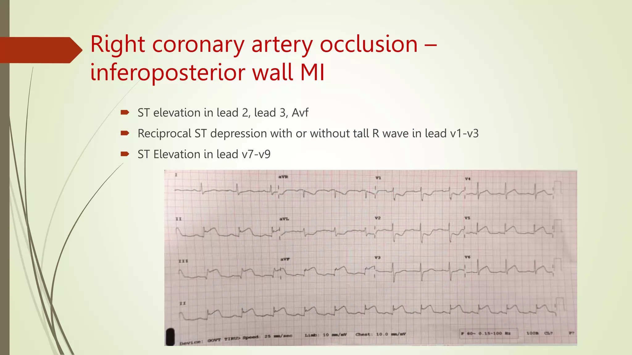 MI LOCALISATION.pptx