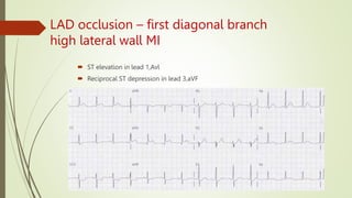 MI LOCALISATION.pptx