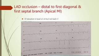 MI LOCALISATION.pptx