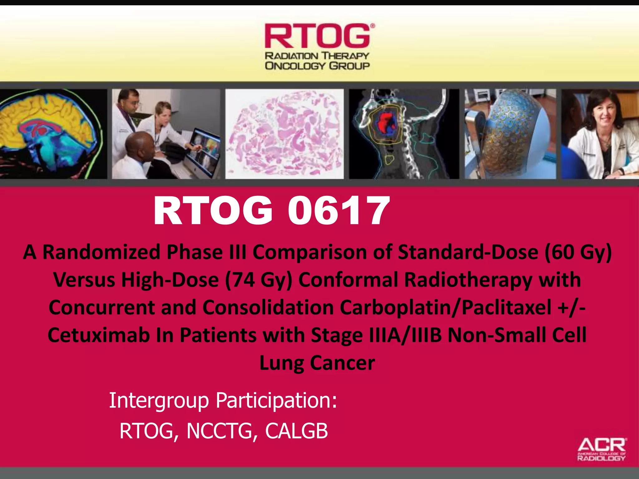 Role of Radiation Therapy for Lung Cancer | PPTX
