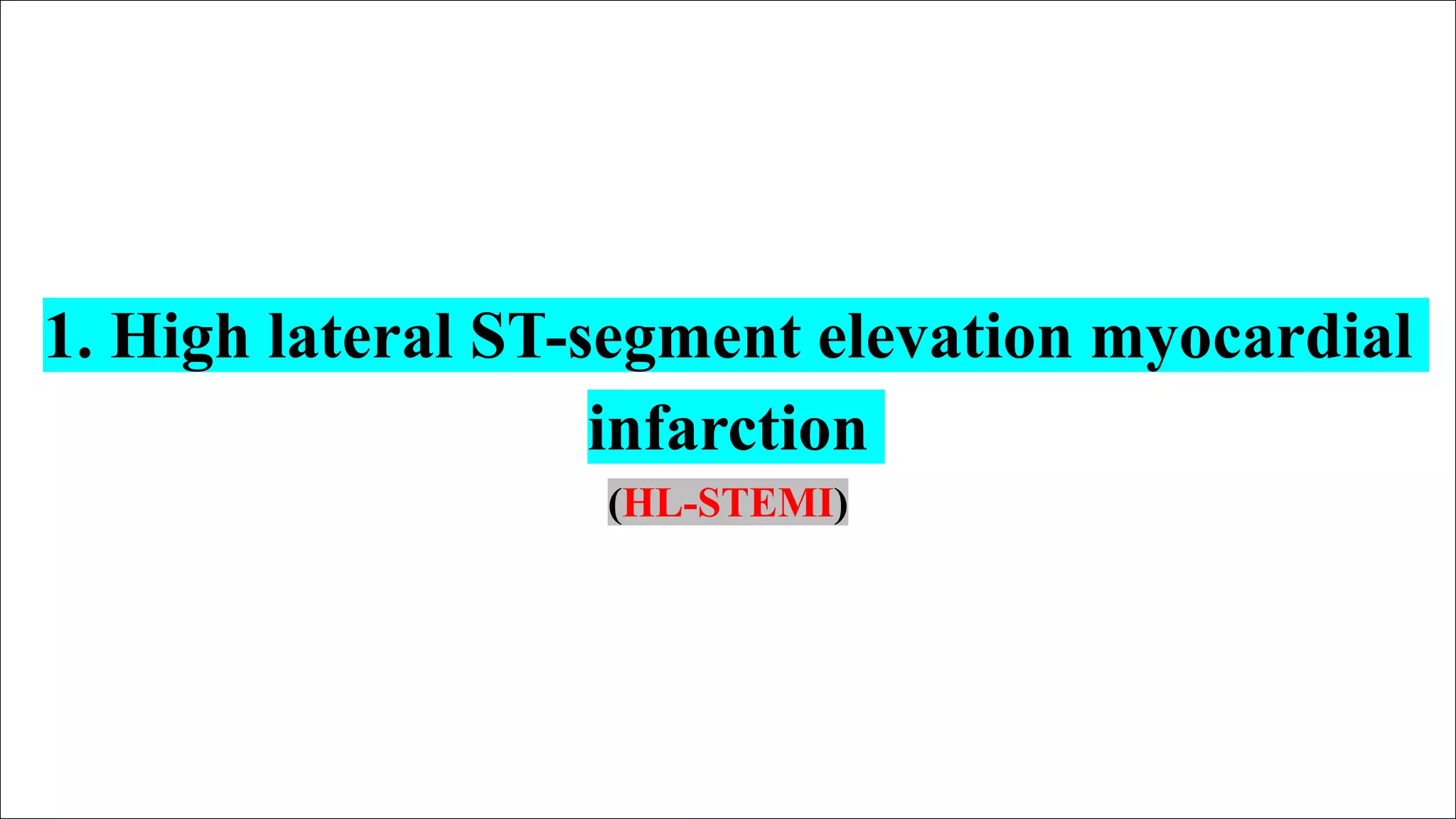 Mimic high lateral myocardial infarction in chest tetany with mirror ...
