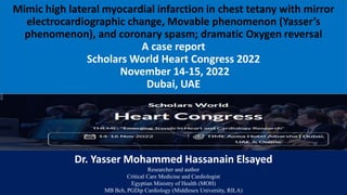 Mimic high lateral myocardial infarction in chest tetany with mirror ...