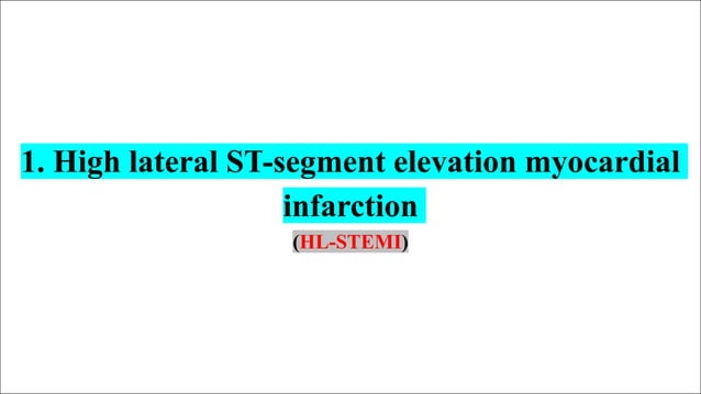 Mimic high lateral myocardial infarction in chest tetany with mirror ...