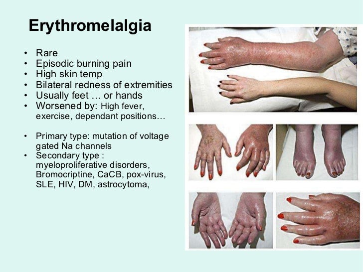 Mimics of infectious_diseases