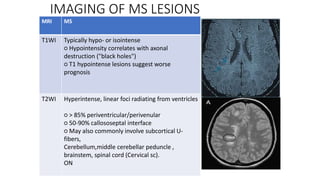 Mimics of MS in MRI copy for neurologist | PPTX