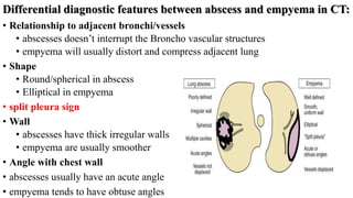 MIM (Lung abscess).pptx