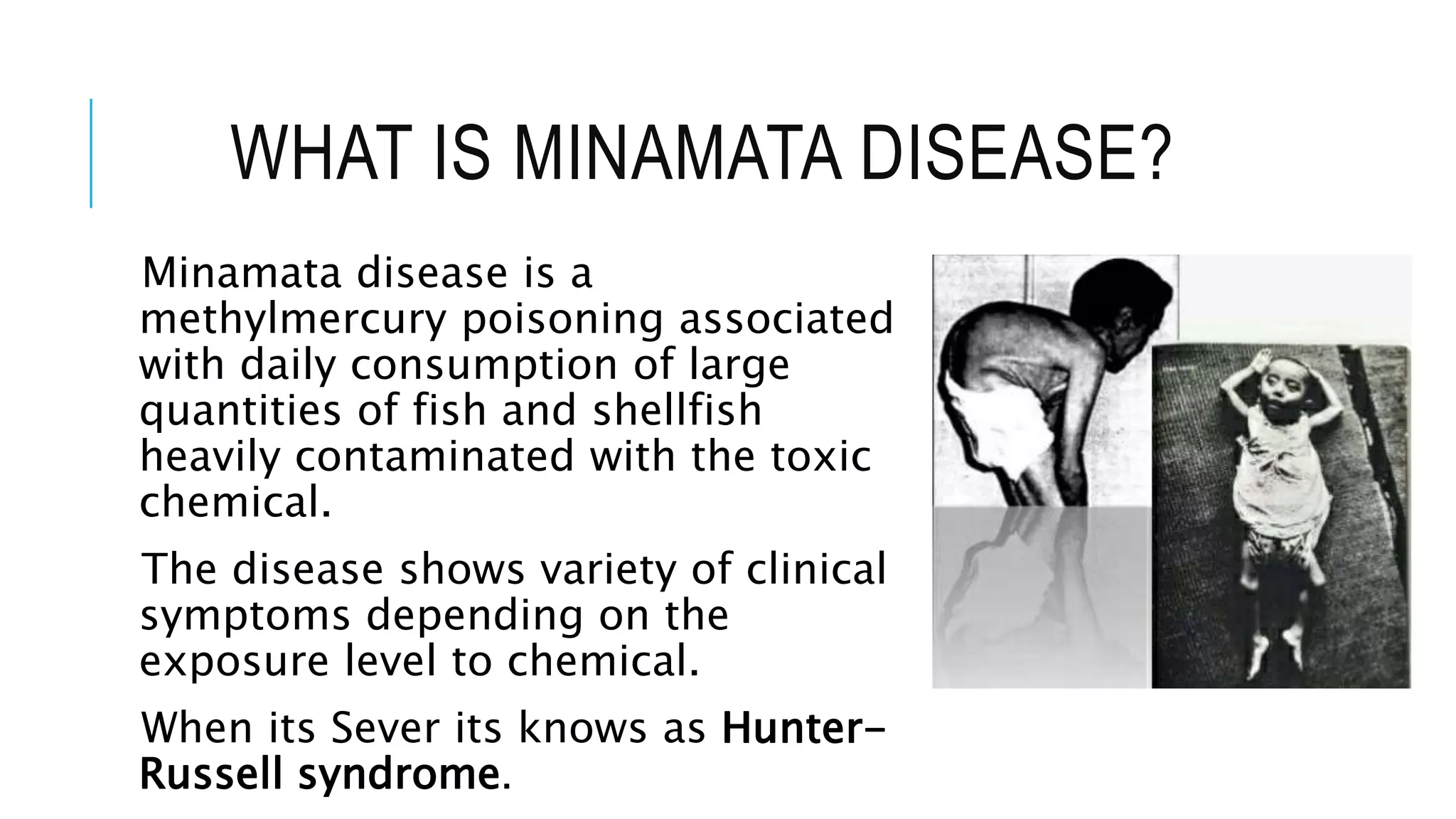 Minamata illness | PPTX