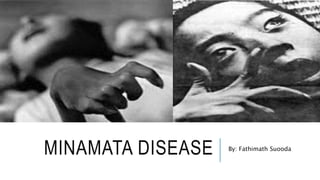 Minamata Disease In Children