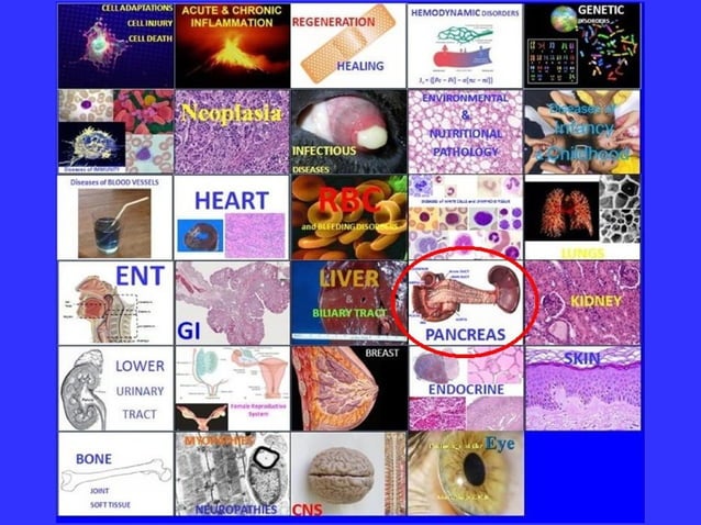 Minarcik robbins 2013_ch19-pancreas | PPT