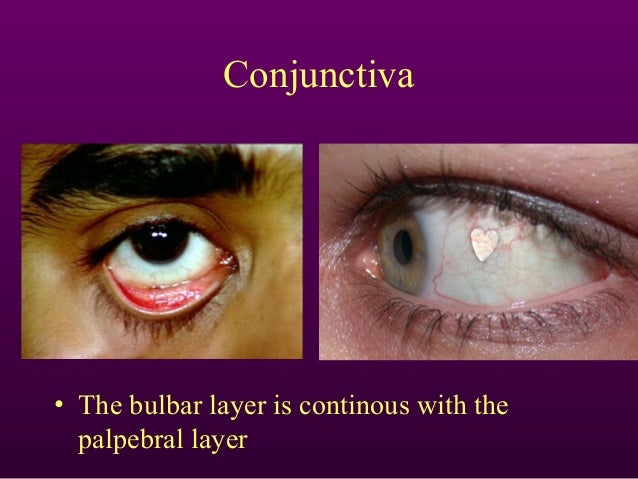 Minarcik robbins 2013_ch29-eye