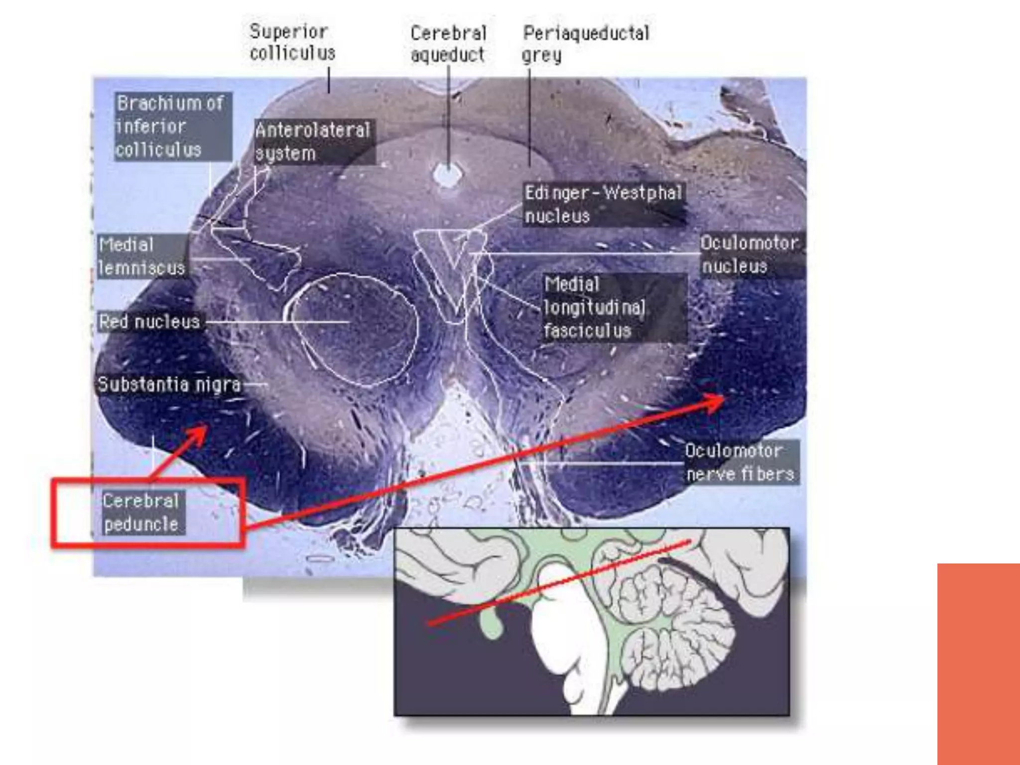 Mind Brain and Behavior | PPTX | Brain and Nervous System Disorders ...