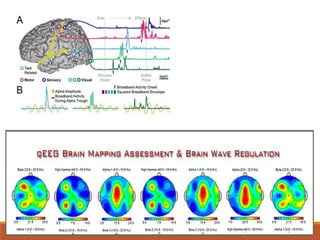 Mind control device | PPT