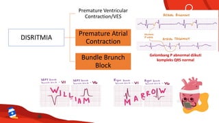 Materi Mind Map Cardiology_unlocked.pdf