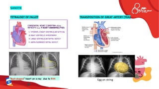 Materi Mind Map Cardiology_unlocked.pdf