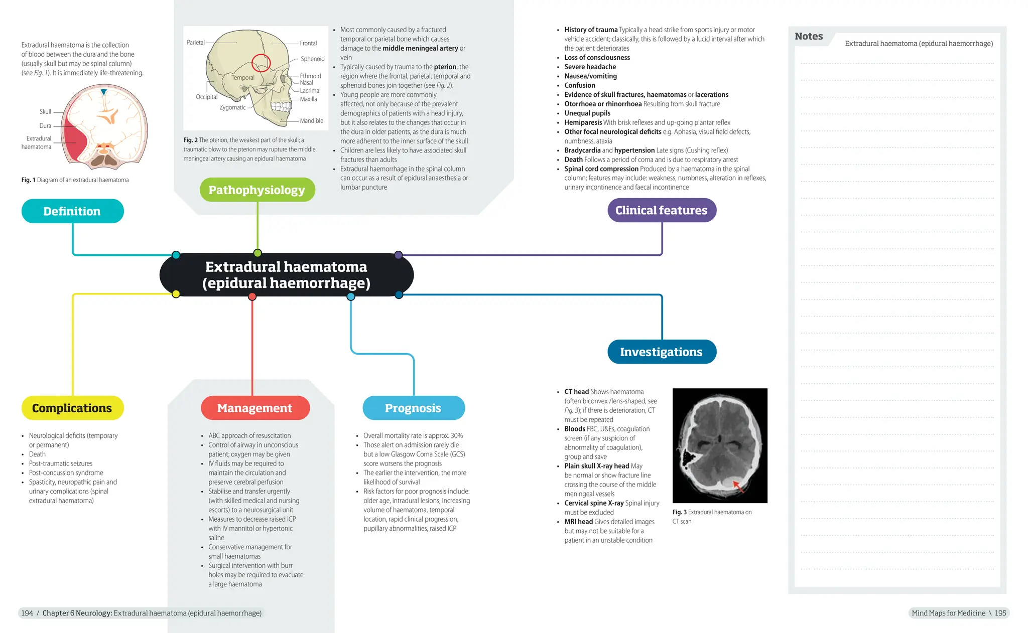 Mind maps medicine surgery Neurology.pdf