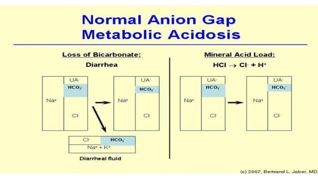 Anion Gap
