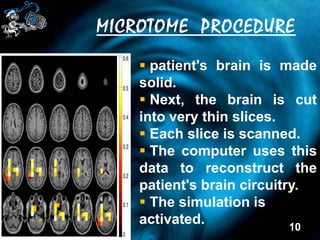 Mind uploading | PPTX