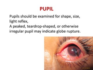 Ruptured Globe Peaked Pupil