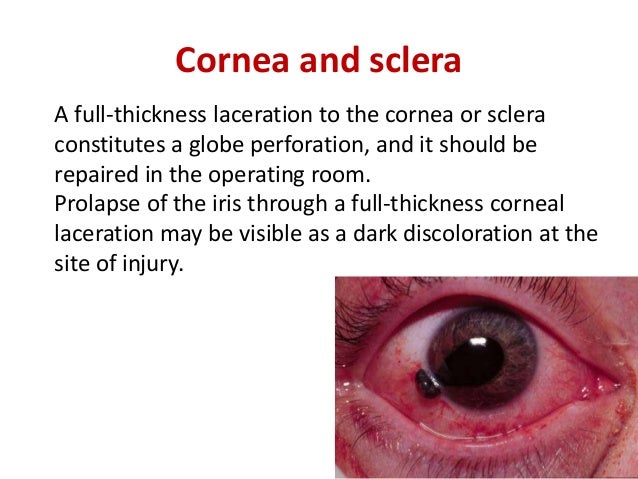 penetrating injury to eye