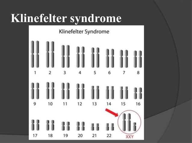 Karyotype &idiogram | PPTX | Genetics | Science