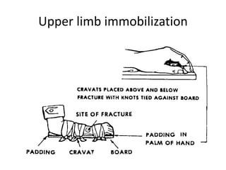 Mine blast Injury First Aid | PPTX