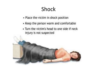 Mine blast Injury First Aid | PPTX