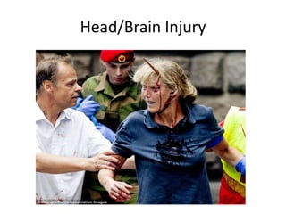 Mine blast Injury First Aid | PPTX