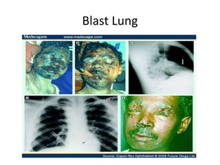 Mine blast Injury First Aid | PPTX