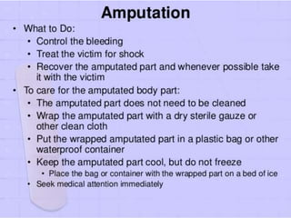 Mine blast Injury First Aid | PPTX