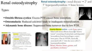 Mineral and Bone Disorder in Chronic Kidney Disease O-H.pdf